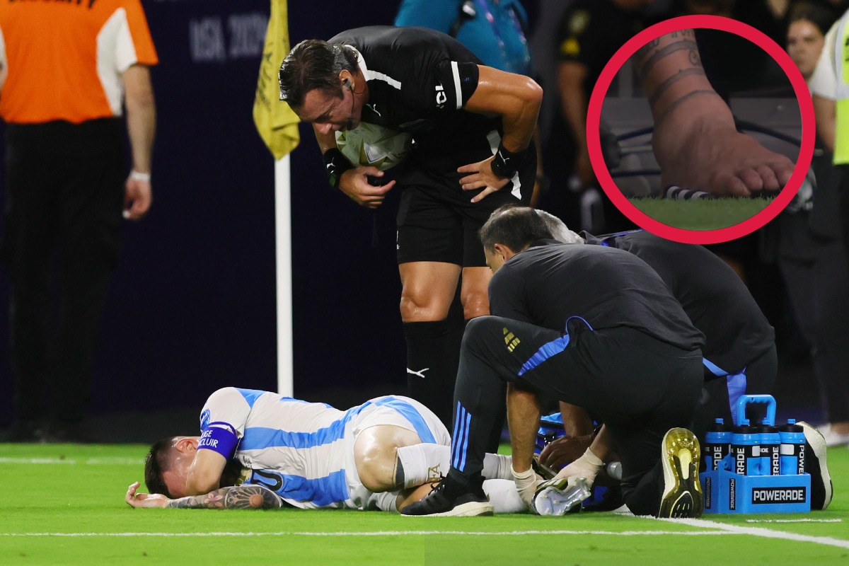 Copa América: cómo le quedó el tobillo a Lionel Messi tras la lesión